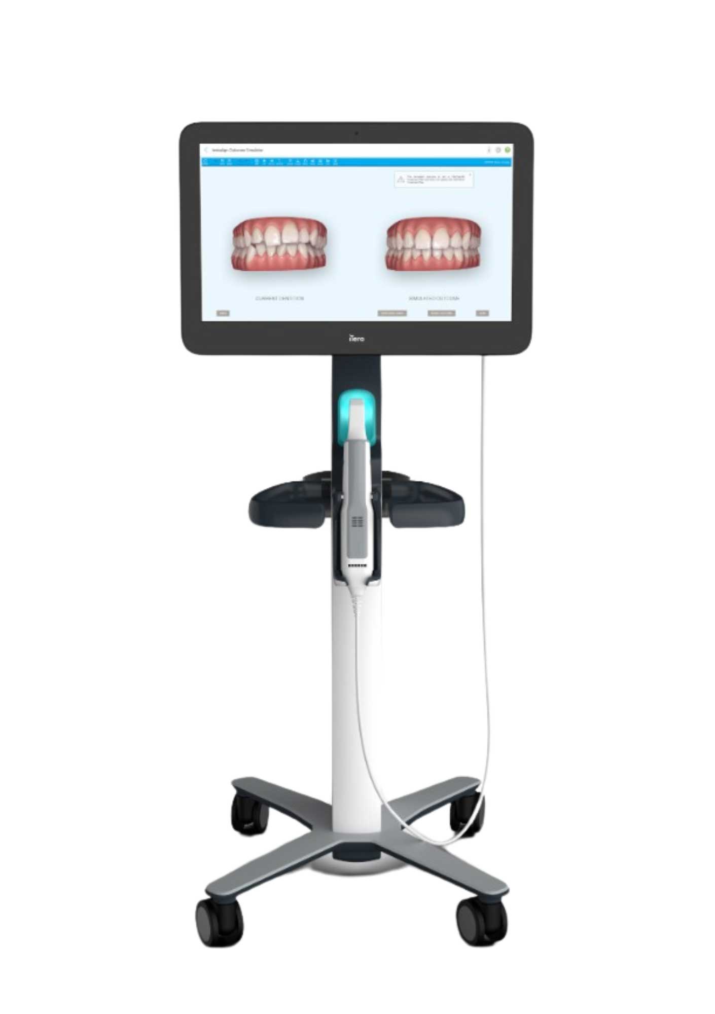 Intraoral Scanning | 口腔内扫描